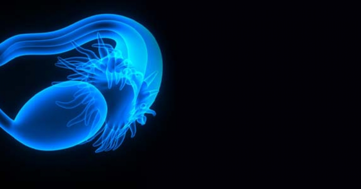 Nowotwór jajnika Diagnostyka | Krajowy Rejestr Nowotworów