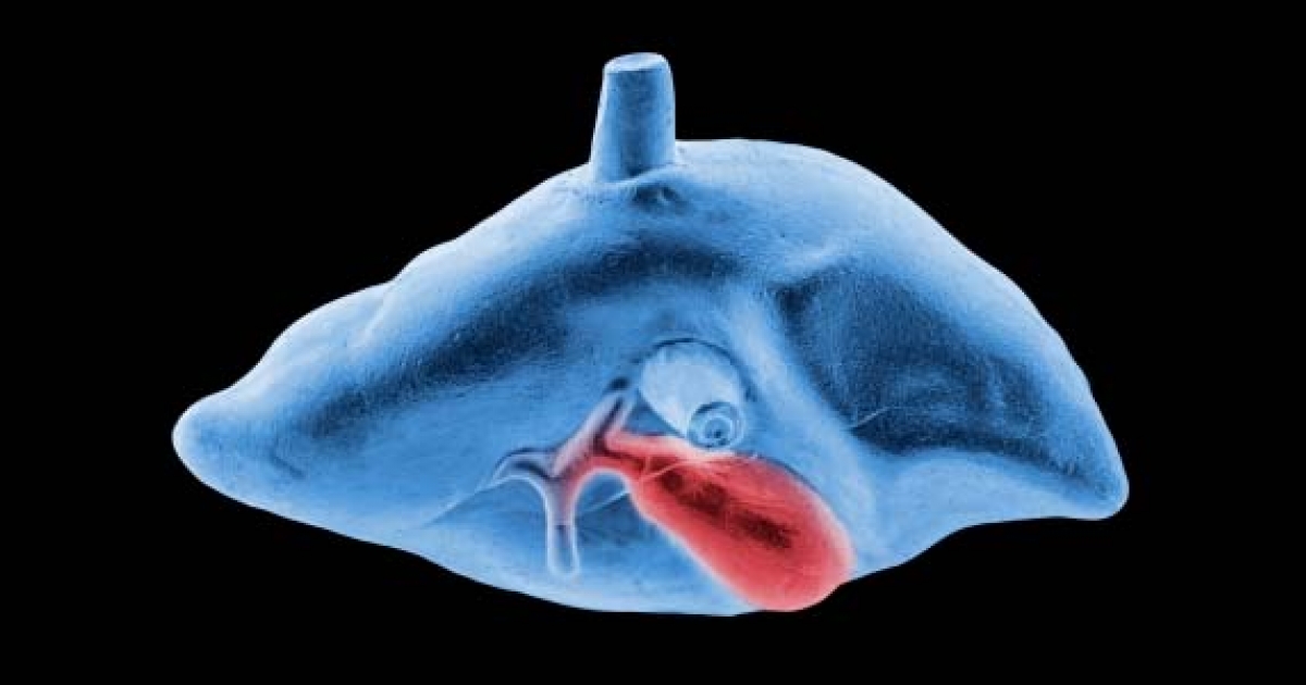 Nowotwór pęcherzyka żółciowego Czym jest? | Krajowy Rejestr Nowotworów